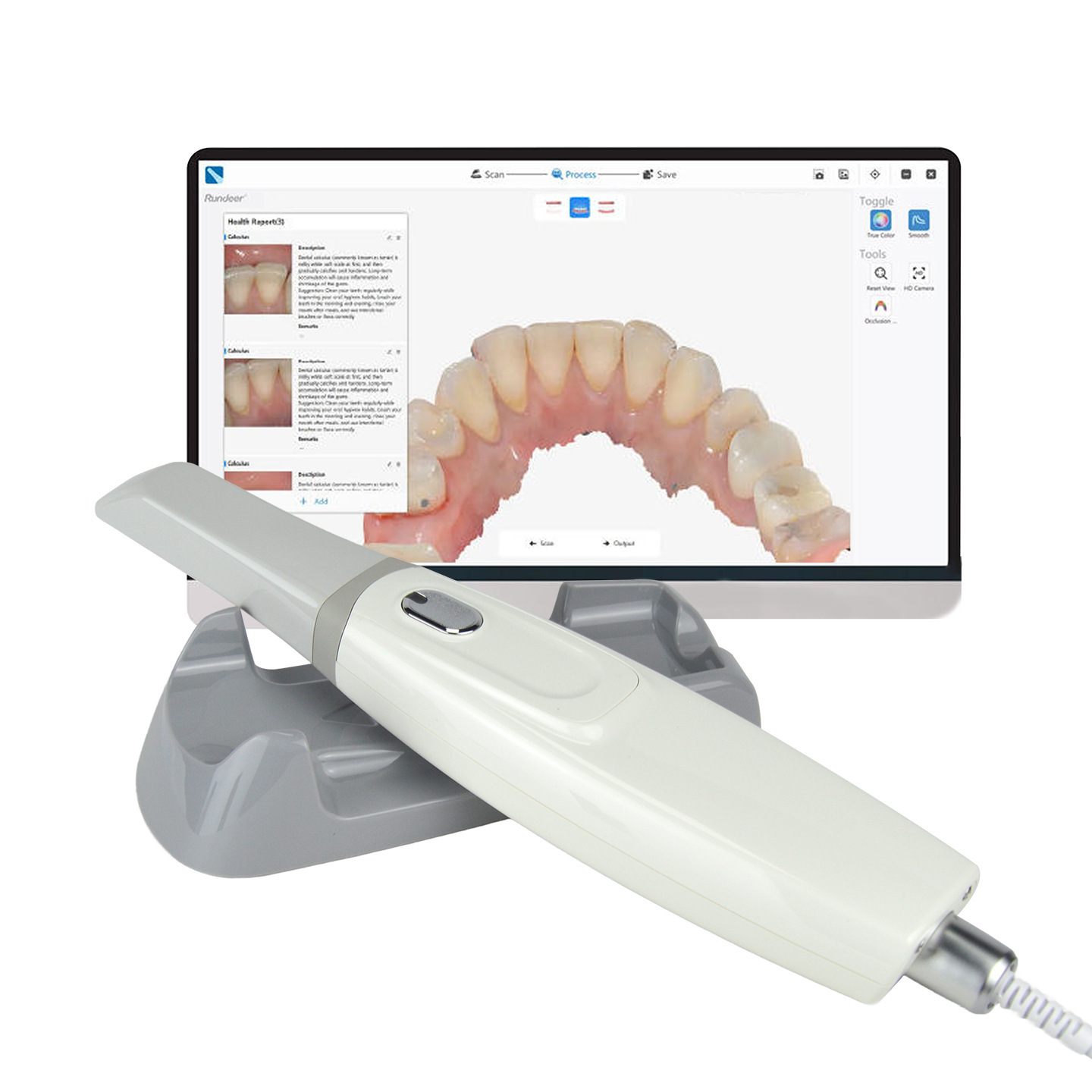 AI-Powered Dental Intraoral Scanner - 90s Full-Arch Scan